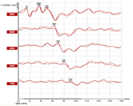 Basic ABR Testing with Eclipse