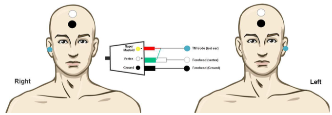 Basic ECochG Testing with Eclipse