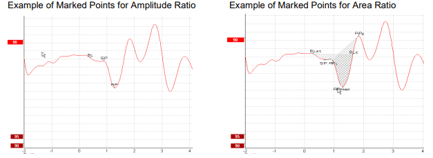 Eclipse | Basic Electrocochleography (ECochG) | Interacoustics