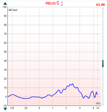 A Beginners Guide to Real Ear Measures (REM)