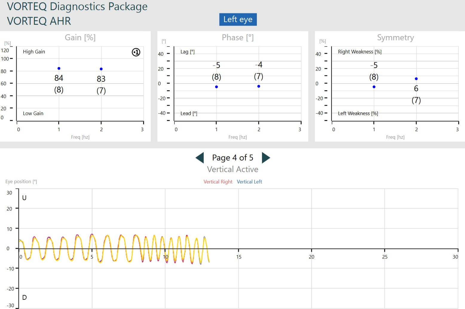 VisualEyes™ | Active Head Rotation | Interacoustics