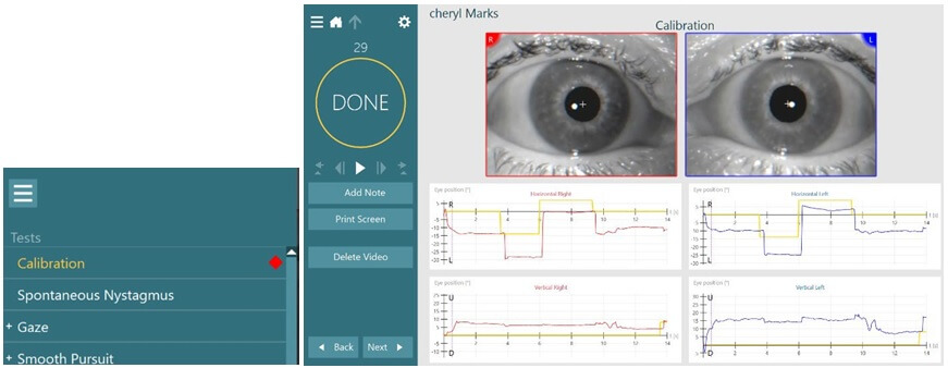 VisualEyes™ | Calibration Procedures | Interacoustics