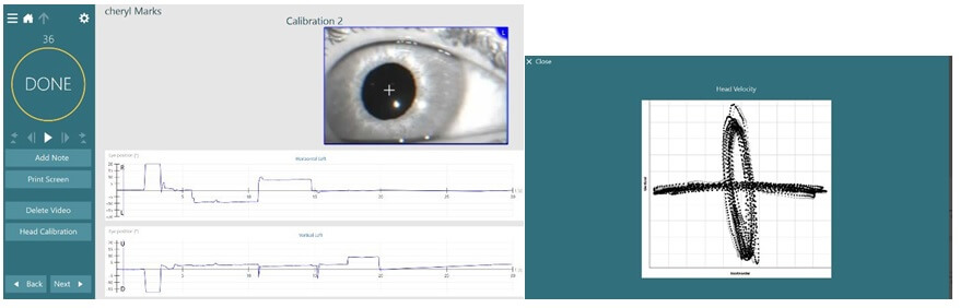 VisualEyes™ | Calibration Procedures | Interacoustics