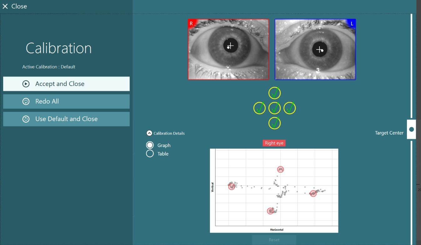VisualEyes™ | Calibration Procedures | Interacoustics
