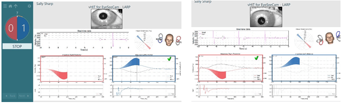 EyeSeeCam in VisualEyes™ | Interacoustics