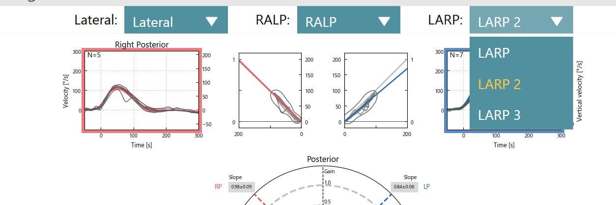 EyeSeeCam in VisualEyes™ | Interacoustics