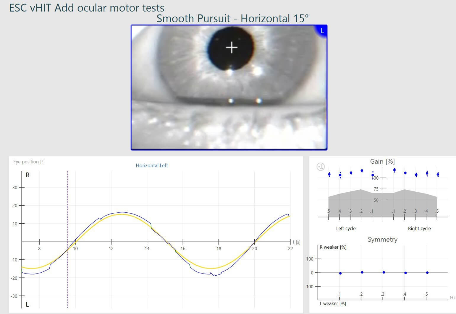EyeSeeCam in VisualEyes™ | Interacoustics