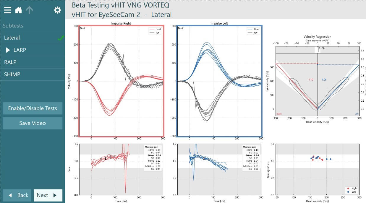 EyeSeeCam in VisualEyes™ | Interacoustics