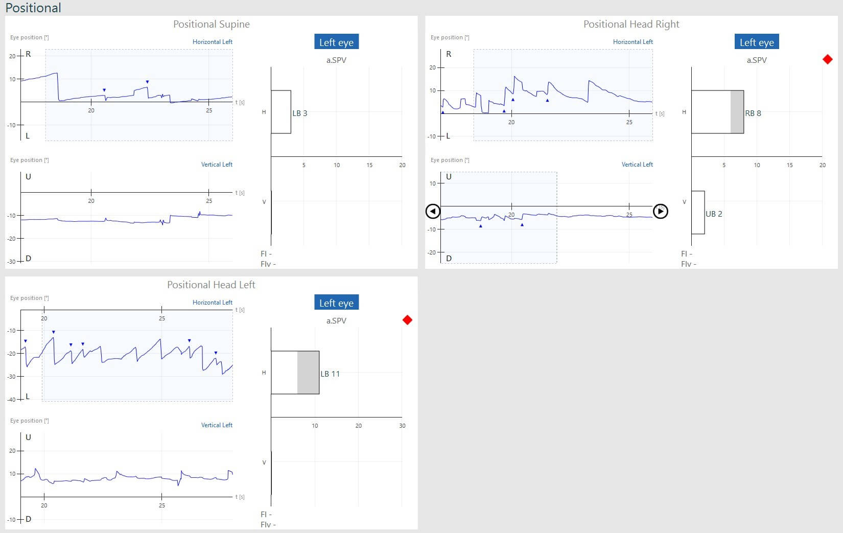 VisualEyes™ | Positional Testing | Interacoustics