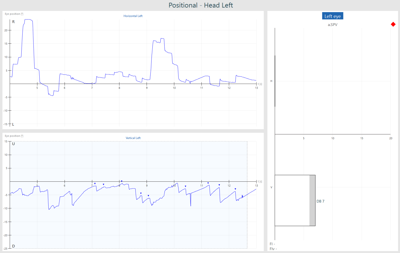 VisualEyes™ | Positional Testing | Interacoustics