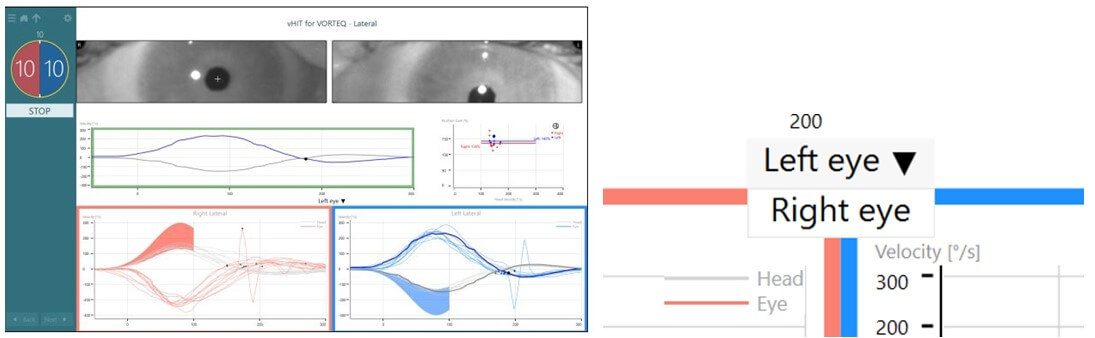 VisualEyes™ | VORTEQ™ vHIT | Interacoustics