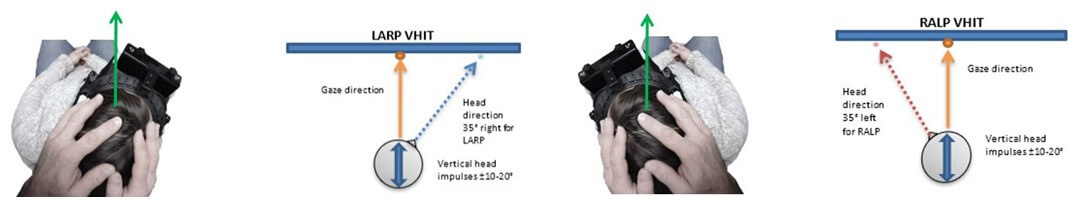 VisualEyes™ | VORTEQ™ vHIT | Interacoustics