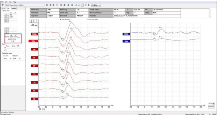 cVEMP testing with Eclipse