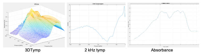 Titan | Wideband Tympanometry Research License | Interacoustics