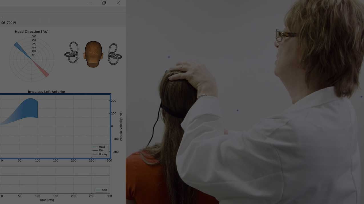 EyeSeeCam vHIT | Video Head Impulse Test | Interacoustics