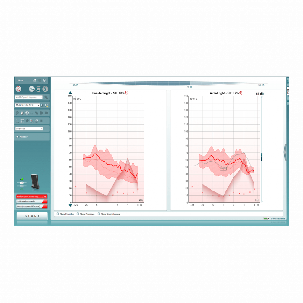 Callisto™ | Portable audiometer | Interacoustics