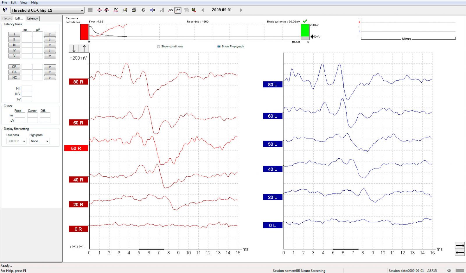 Eclipse | Evoked potentials device | Interacoustics