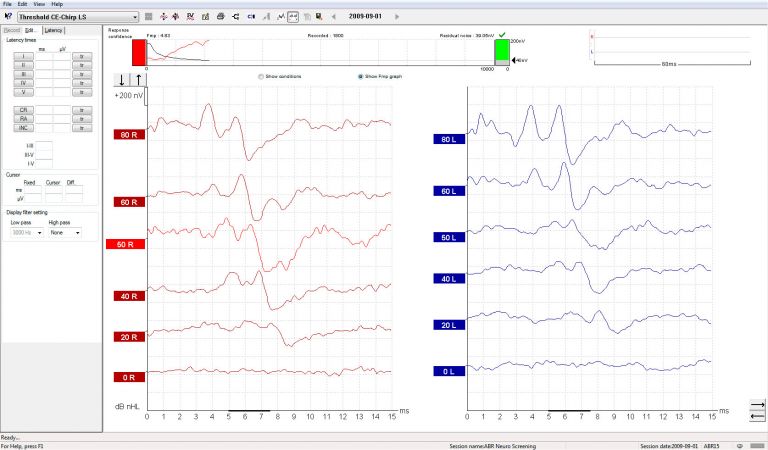 Eclipse | Evoked potentials device | Interacoustics