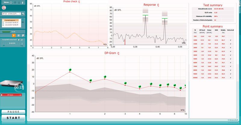 Eclipse | Evoked potentials device | Interacoustics