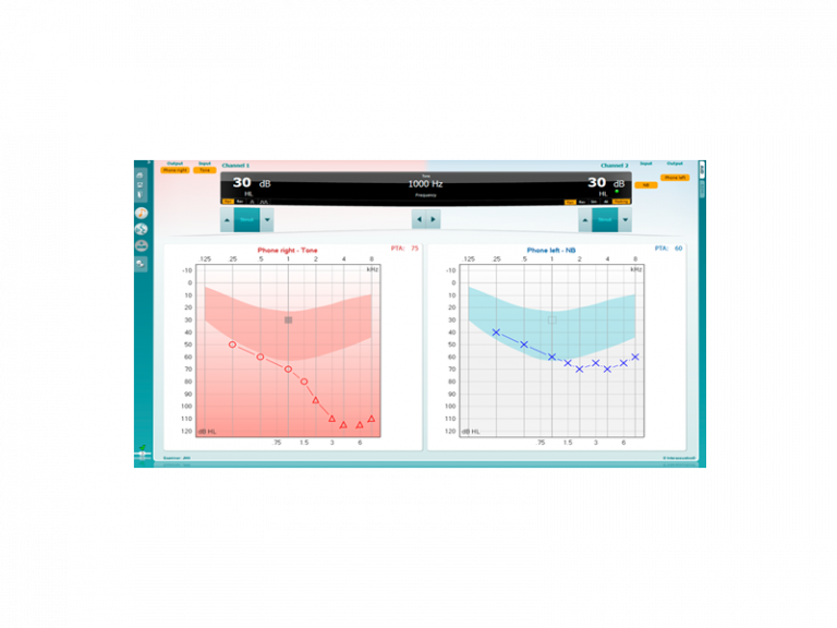 Diagnostic Suite Support | Interacoustics
