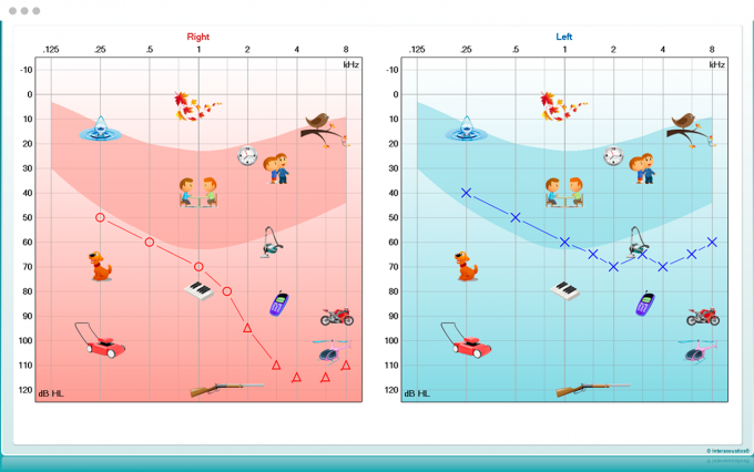 AC40 | Clinical audiometer | Interacoustics