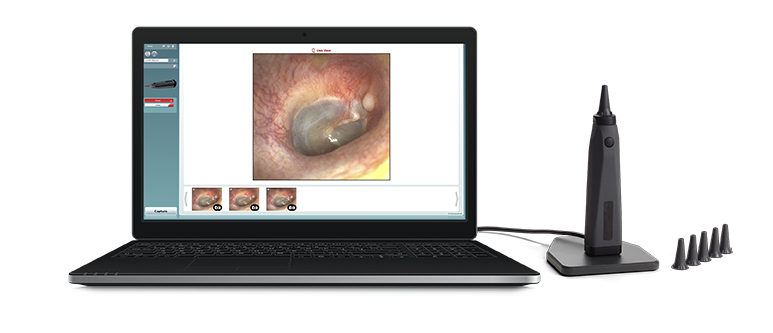 Viot | Video otoscope | Interacoustics